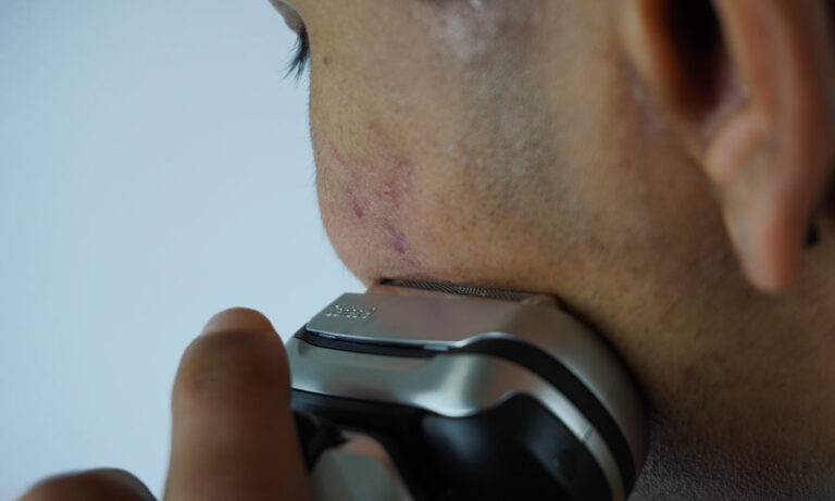 7 Best Electric Shavers for Sensitive Skin: No Burn, No Irritation
